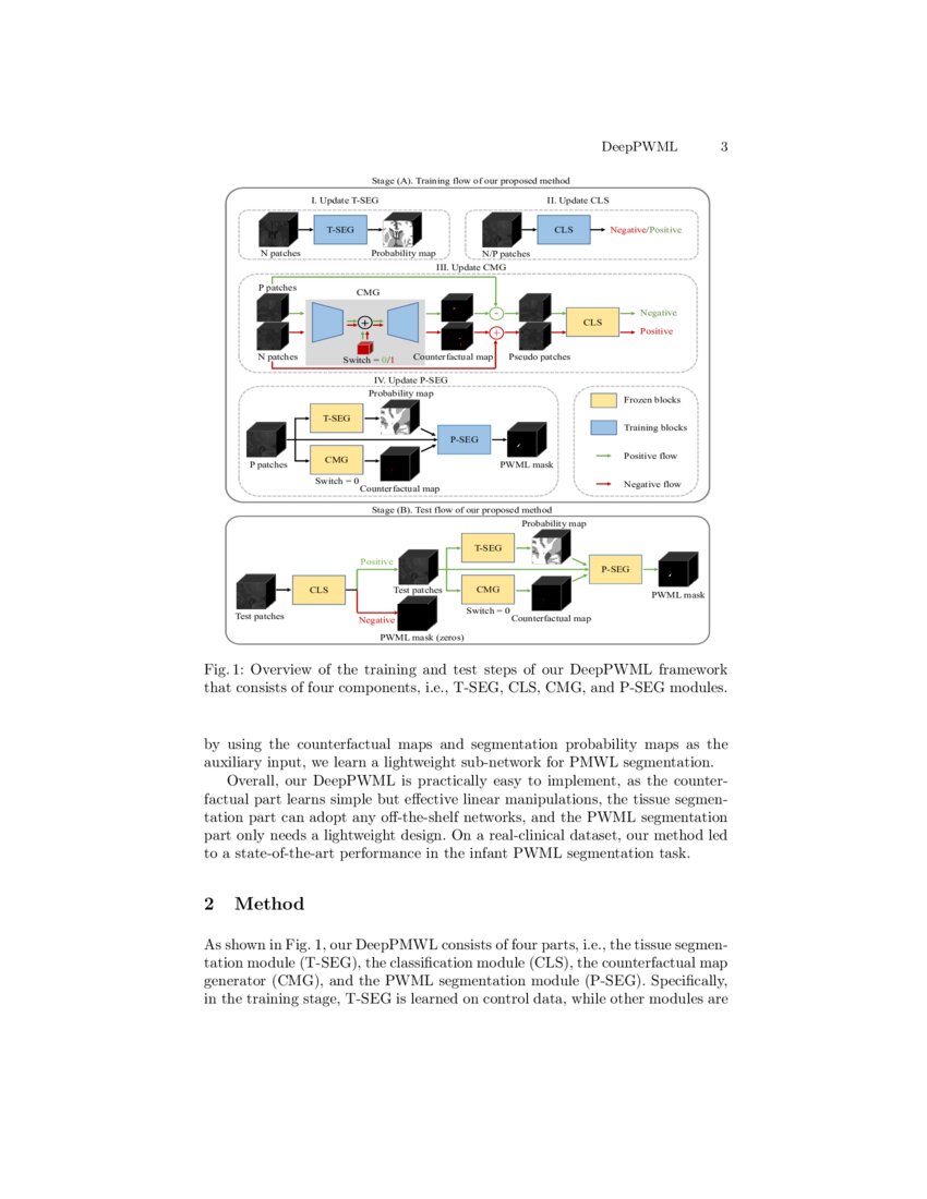 Punctate White Matter Lesion Segmentation In Preterm Infants Powered By Counterfactually