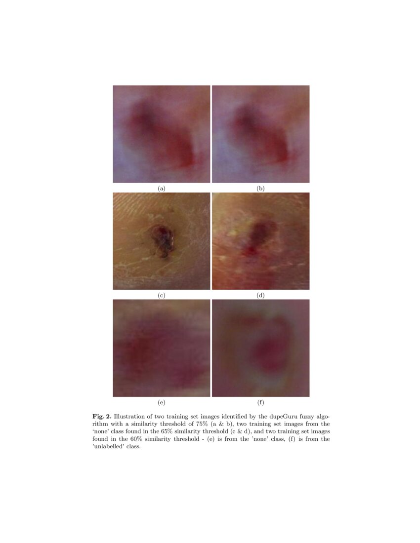 Quantifying the Effect of Image Similarity on Diabetic Foot Ulcer Classification | DeepAI