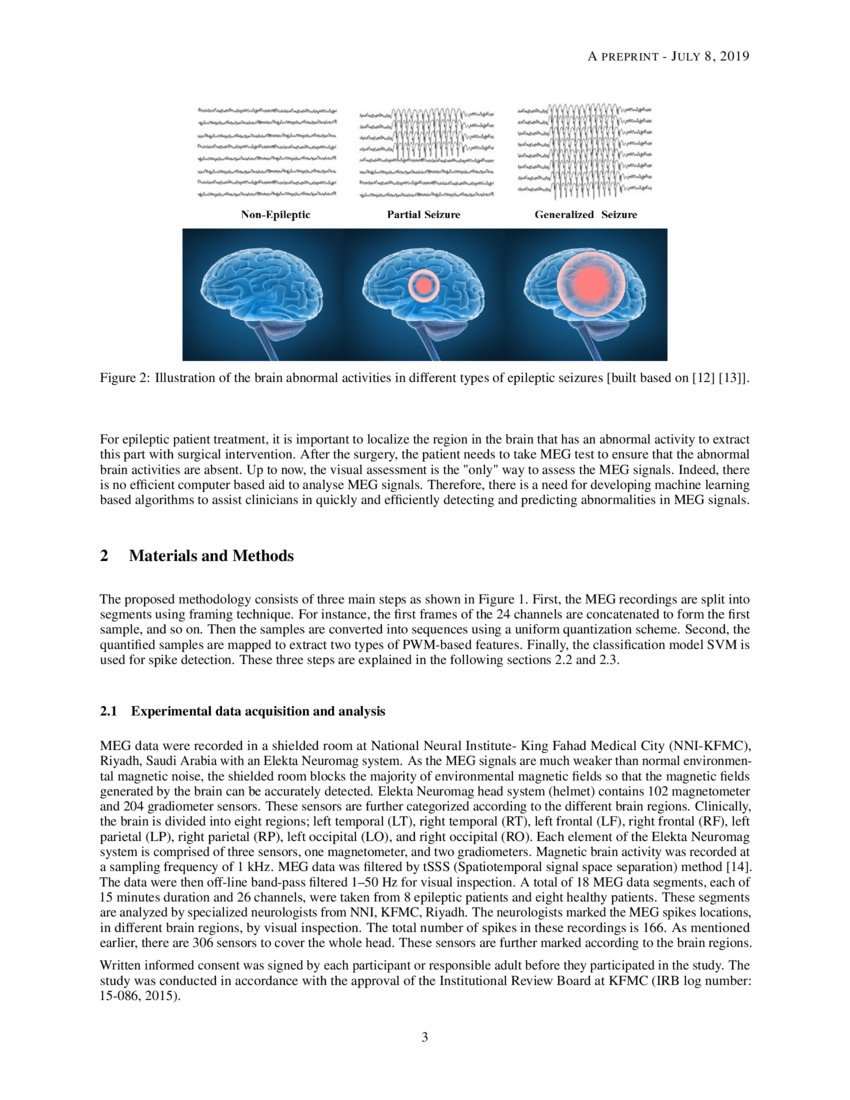 Qupwm Feature Extraction Method For Meg Epileptic Spike Detection Deepai