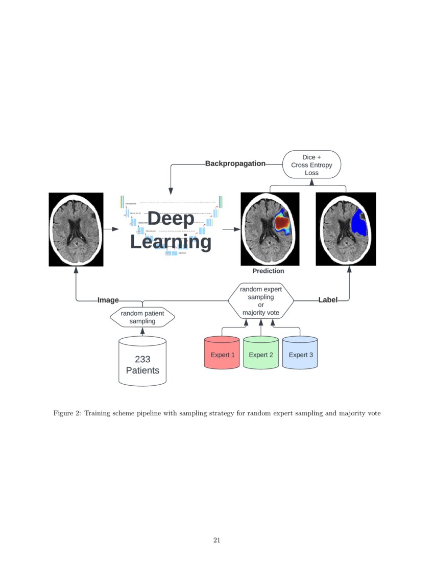 Random Expert Sampling For Deep Learning Segmentation Of Acute Ischemic Stroke On Non Contrast