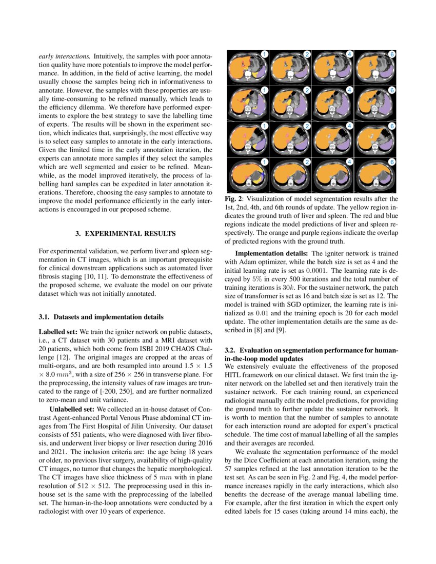 Rapid model transfer for medical image segmentation via iterative human-in-the-loop update: from ...