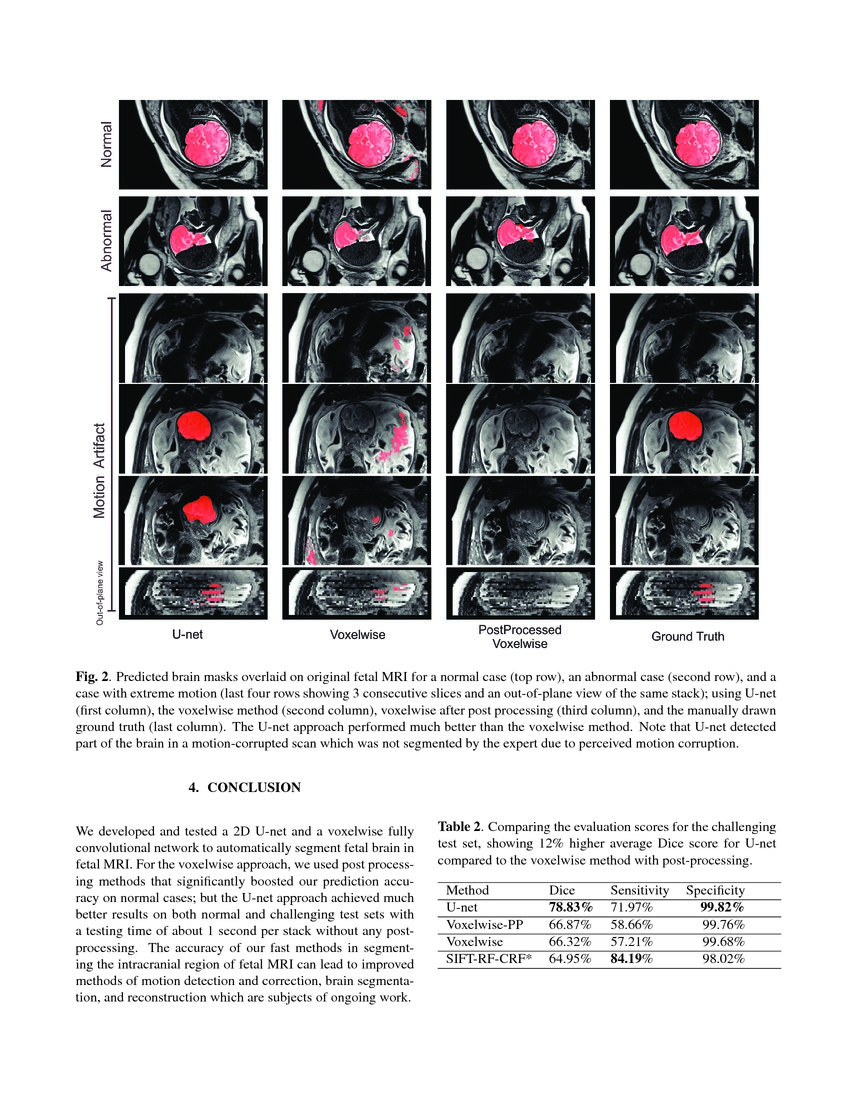 Real Time Automatic Fetal Brain Extraction In Fetal Mri By Deep