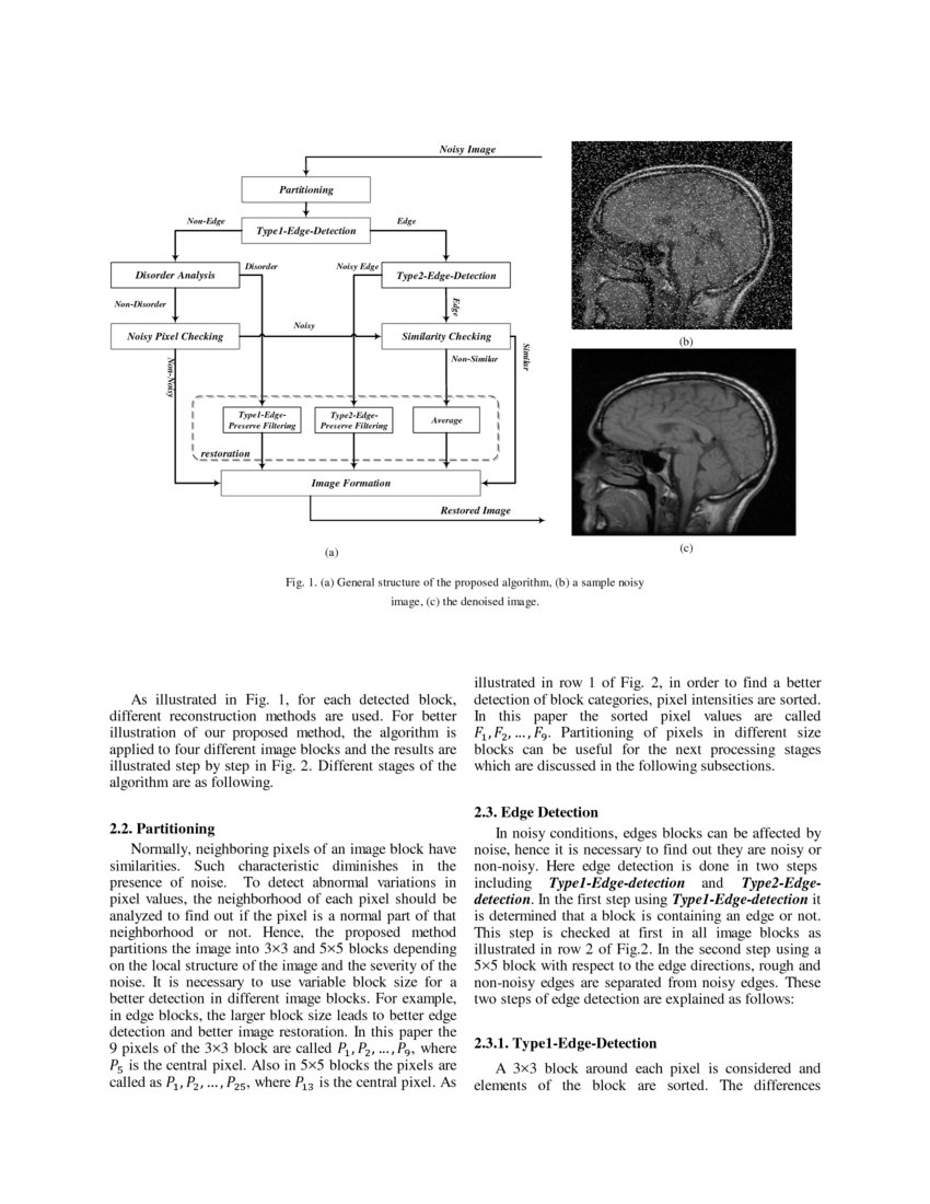 Real-Time Impulse Noise Removal from MR Images for Radiosurgery ...