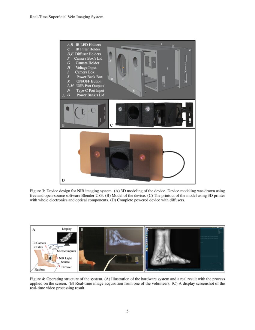 Real-Time Superficial Vein Imaging System for Observing Abnormalities on Vascular Structures ...