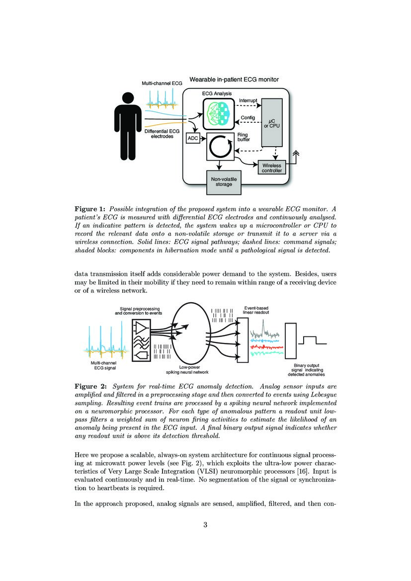 Real Time Ultra Low Power Ecg Anomaly Detection Using An Event Driven
