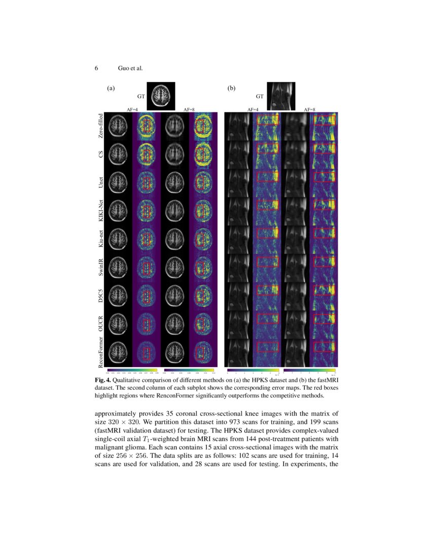ReconFormer: Accelerated MRI Reconstruction Using Recurrent Transformer ...