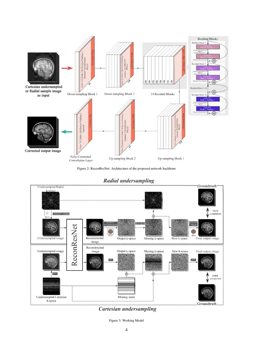 ReconResNet: Regularised Residual Learning for MR Image Reconstruction ...