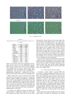 Red Blood Cell Segmentation with Overlapping Cell Separation and Classification on Imbalanced ...