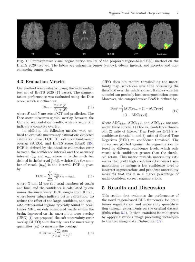 Region-Based Evidential Deep Learning to Quantify Uncertainty and ...