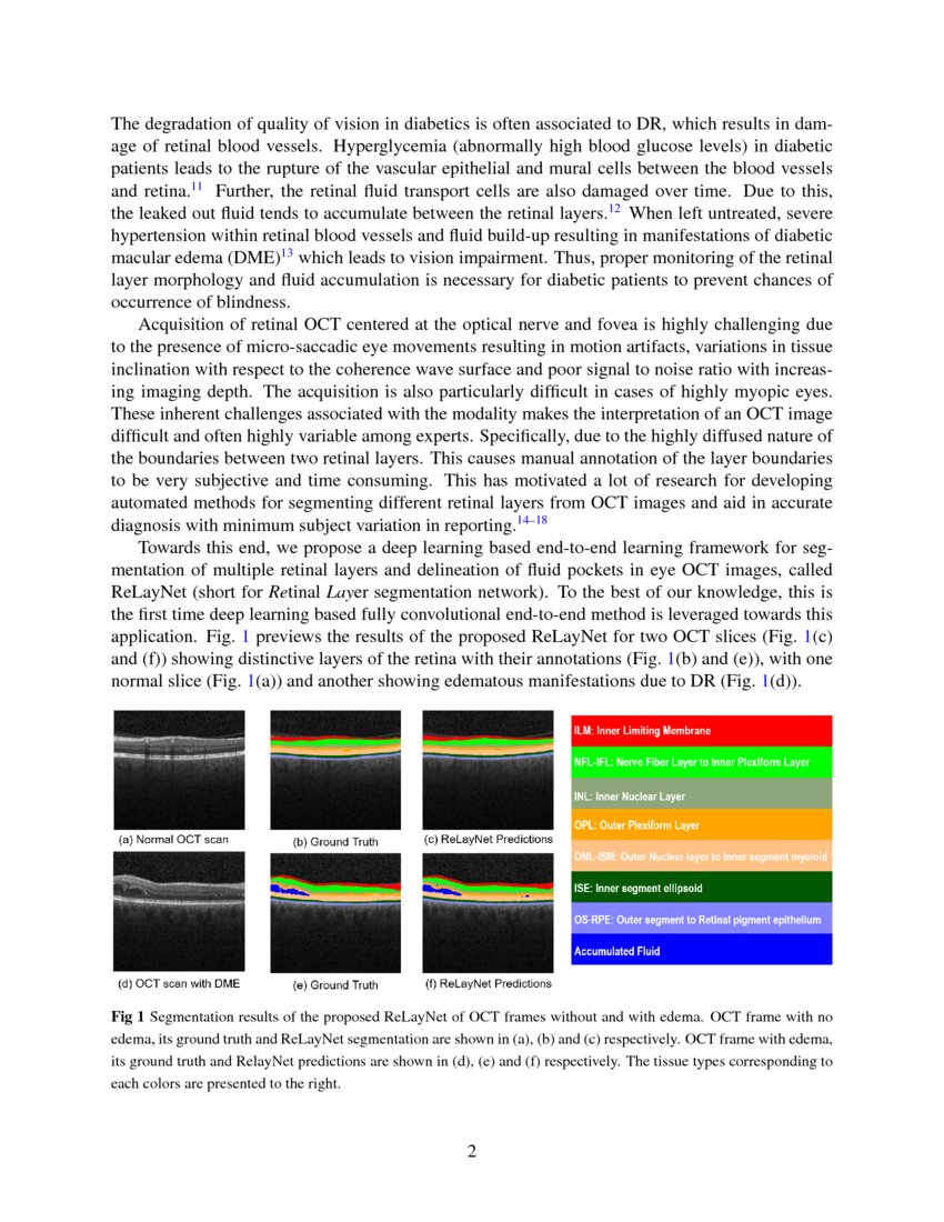 Relaynet Retinal Layer And Fluid Segmentation Of Macular Optical Coherence Tomography Using