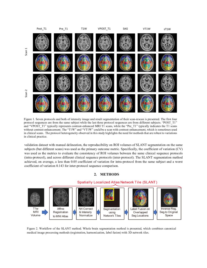 Reproducibility Evaluation Of Slant Whole Brain Segmentation Across