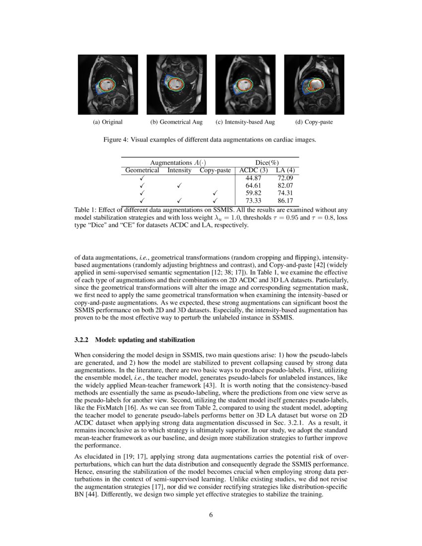 Rethinking Data Perturbation and Model Stabilization for Semi-supervised Medical Image ...