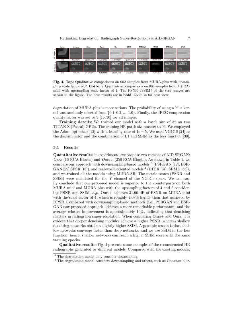 Rethinking Degradation Radiograph Super Resolution Via Aid Srgan Deepai