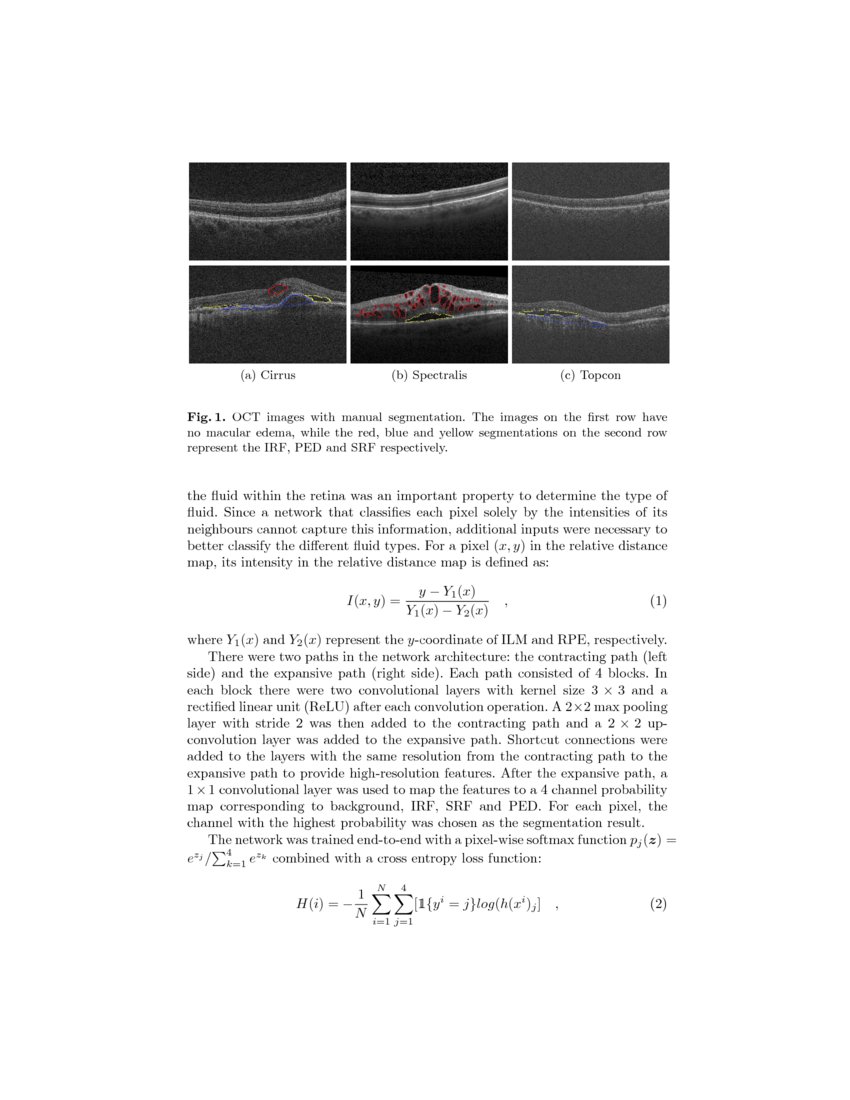 Retinal Fluid Segmentation and Detection in Optical Coherence Tomography Images using Fully ...
