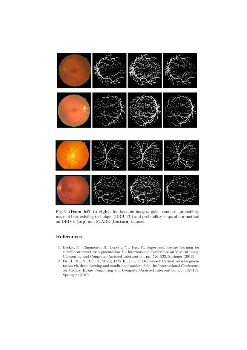 Retinal Vessel Segmentation in Fundoscopic Images with Generative ...