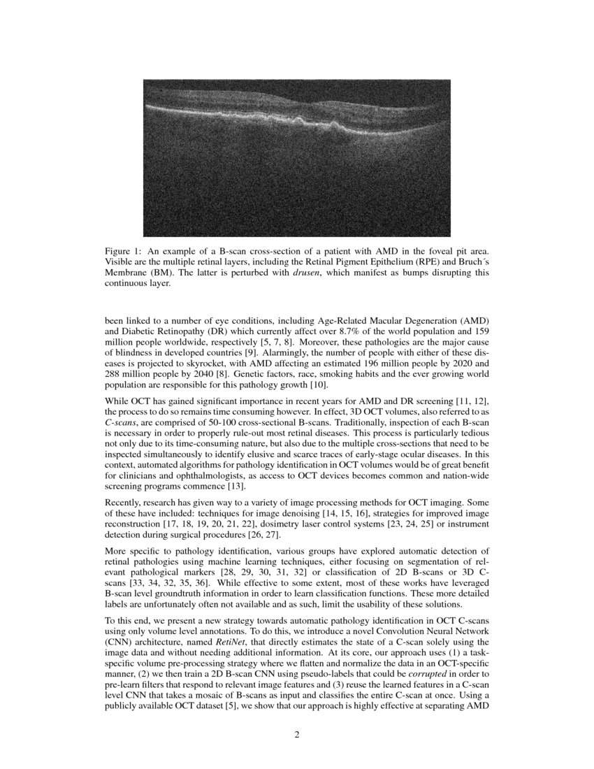 RetiNet: Automatic AMD identification in OCT volumetric data | DeepAI