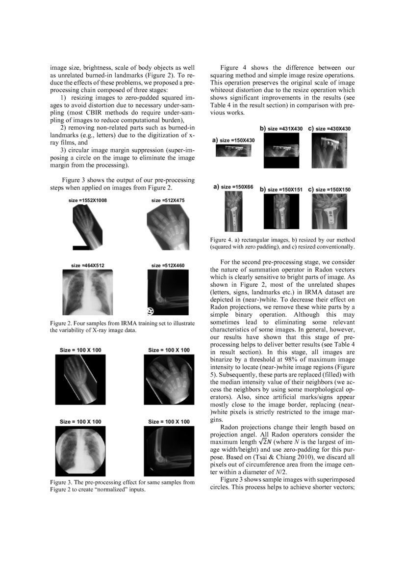 Retrieving Similar X-Ray Images from Big Image Data Using Radon ...