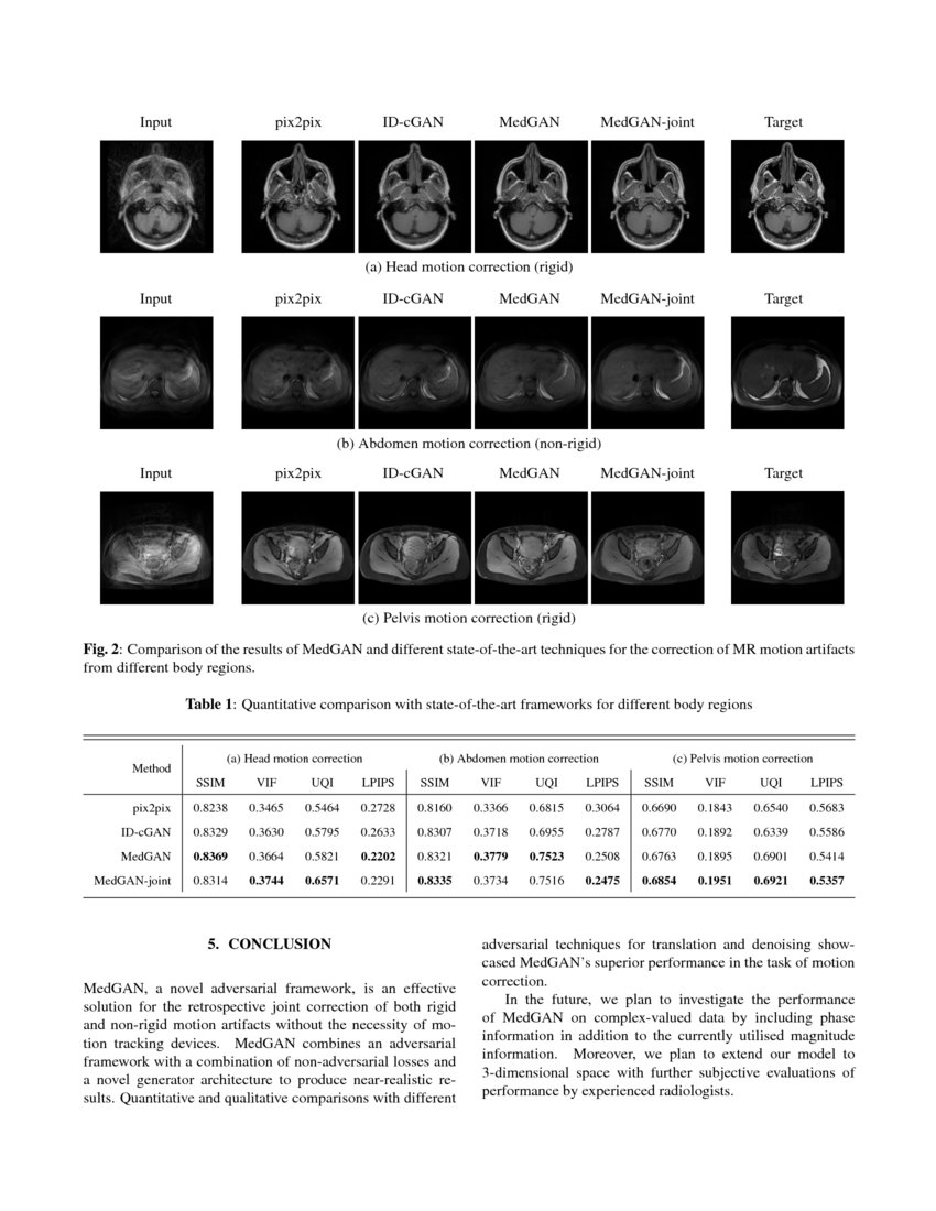 Retrospective correction of Rigid and Non-Rigid MR motion artifacts ...