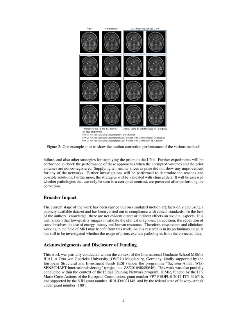 Retrospective Motion Correction of MR Images using Prior-Assisted Deep ...