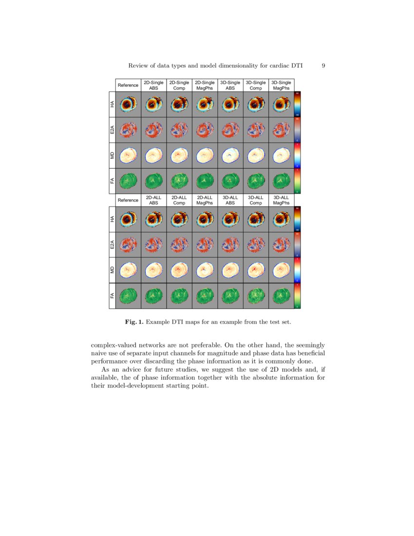 Review of data types and model dimensionality for cardiac DTI SMS ...