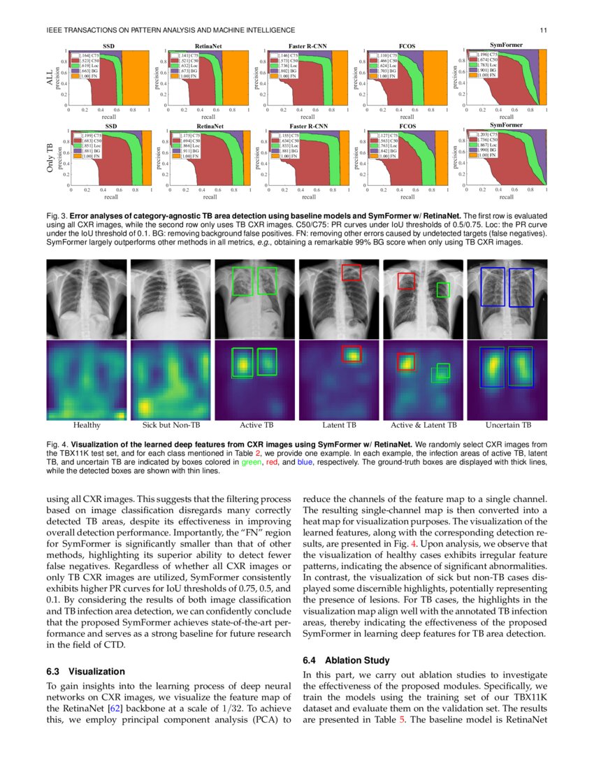 Revisiting Computer Aided Tuberculosis Diagnosis Deepai