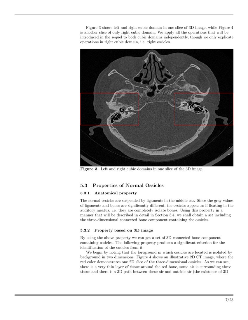 Ricci Curvature Based Volumetric Segmentation of the Auditory Ossicles ...