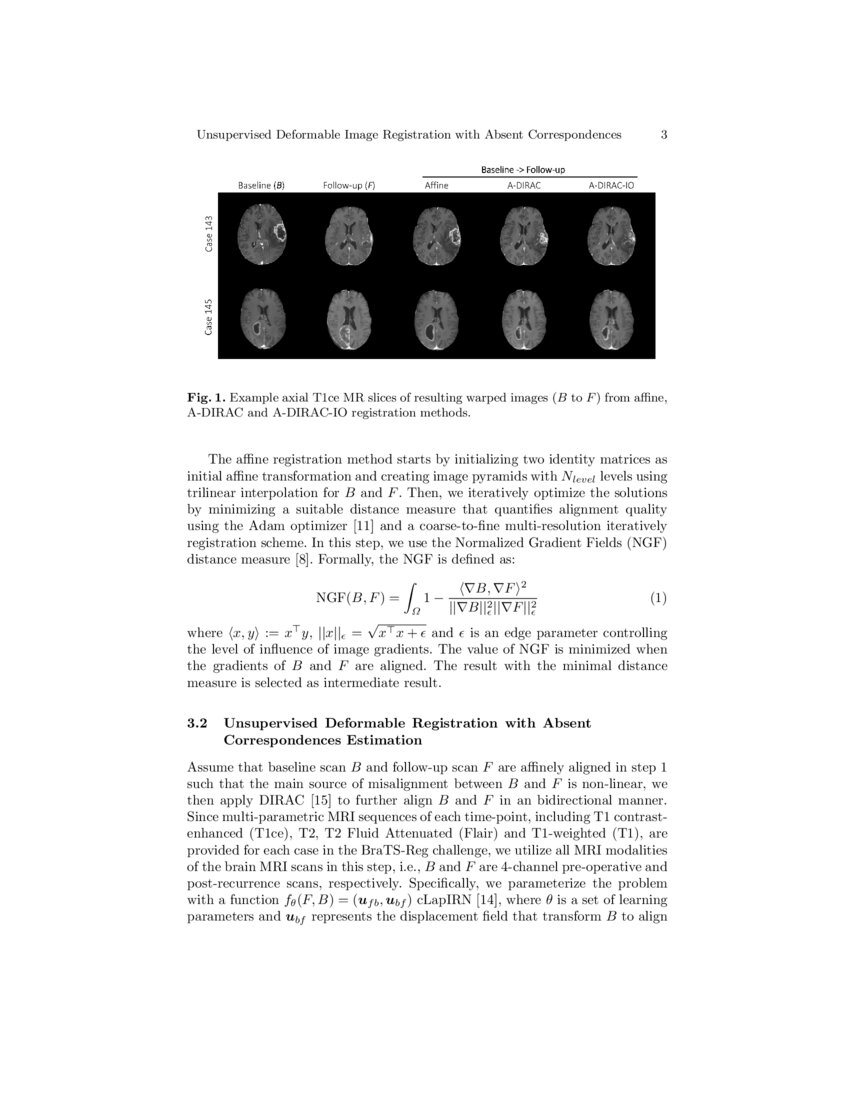 Robust Image Registration with Absent Correspondences in Pre-operative ...