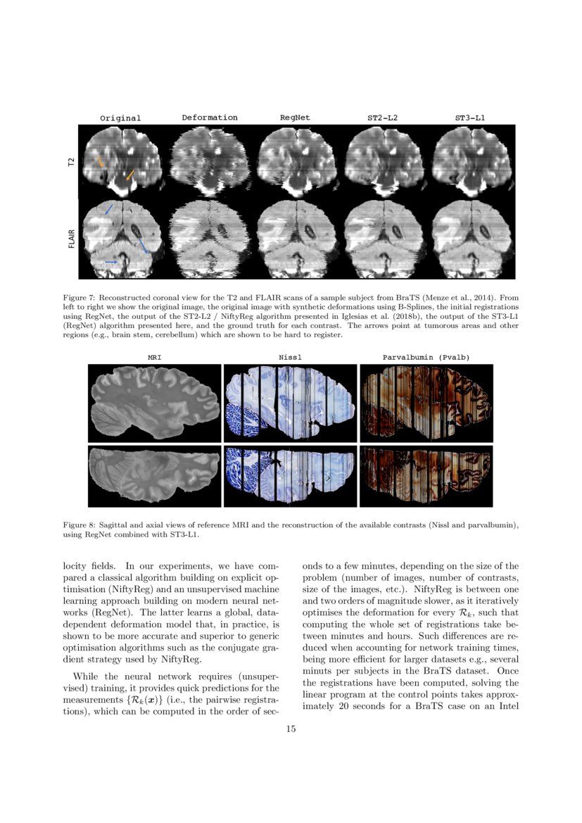 Robust Joint Registration Of Multiple Stains And Mri For Multimodal 3d Histology Reconstruction