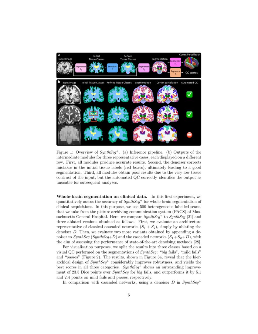 Robust machine learning segmentation for large-scale analysis of heterogeneous clinical brain ...