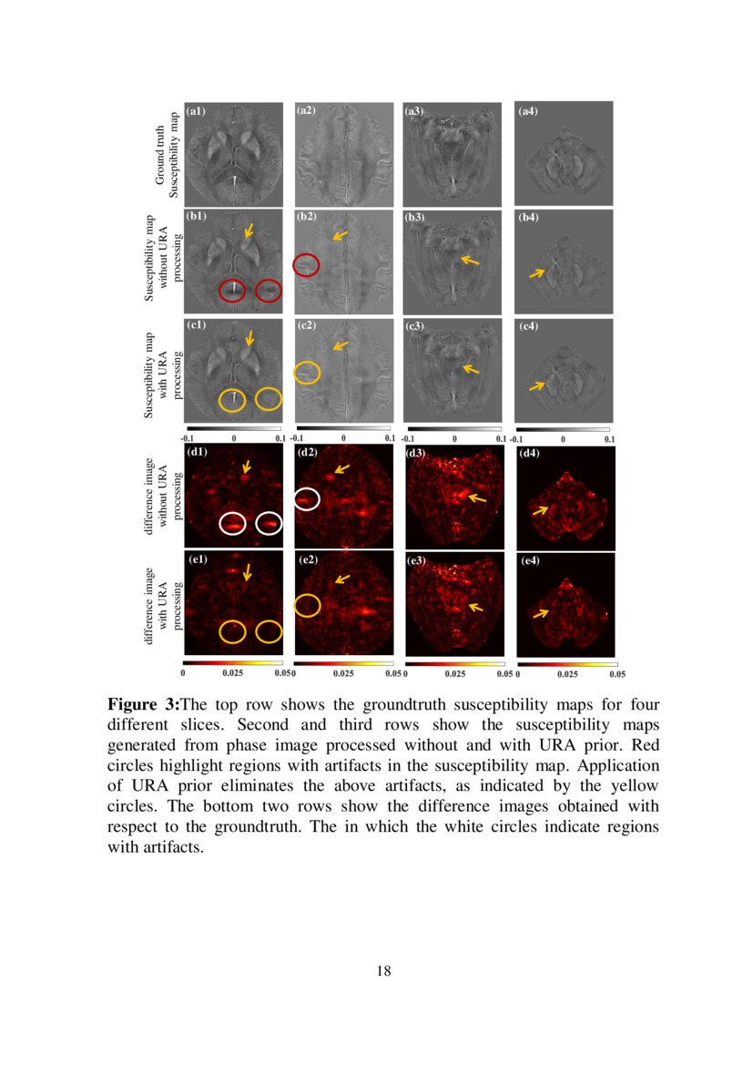 Robust Multi-echo GRE Phase processing using a unity rank enforced complex exponential model ...