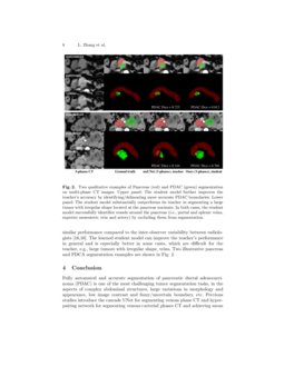 Robust Pancreatic Ductal Adenocarcinoma Segmentation with Multi-Institutional Multi-Phase ...