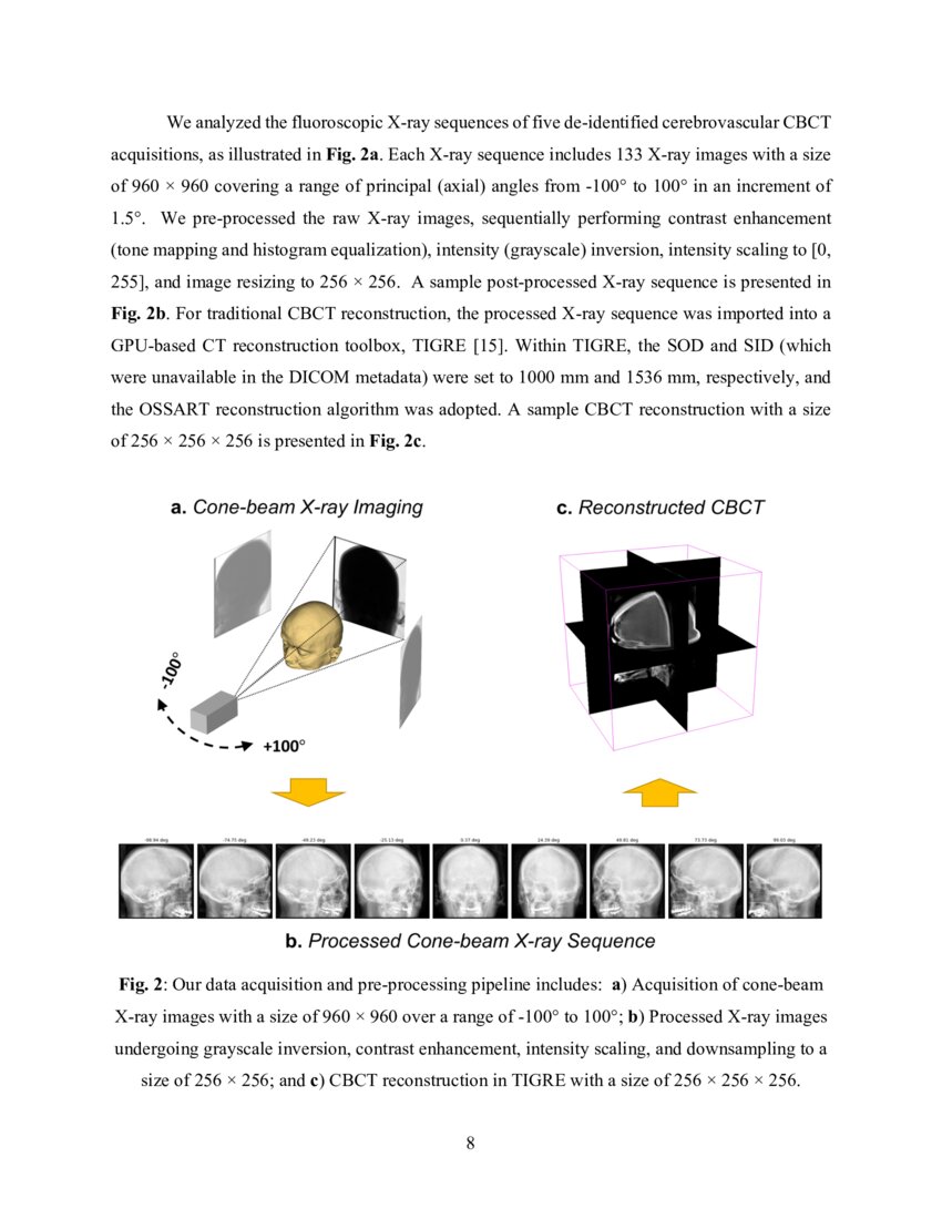 Robust Single-view Cone-beam X-ray Pose Estimation with Neural Tuned Tomography (NeTT) and ...