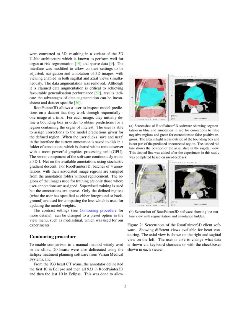 RootPainter3D: Interactive-machine-learning enables rapid and accurate ...