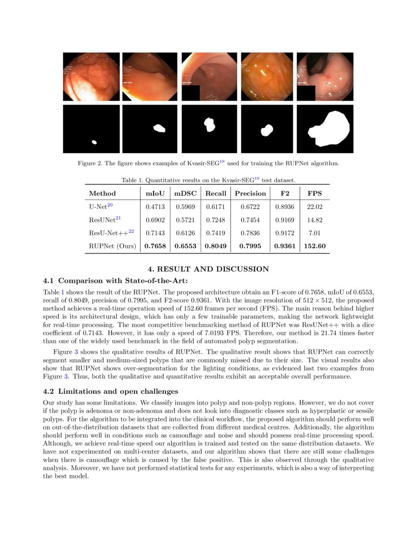 RUPNet: Residual upsampling network for real-time polyp segmentation | DeepAI