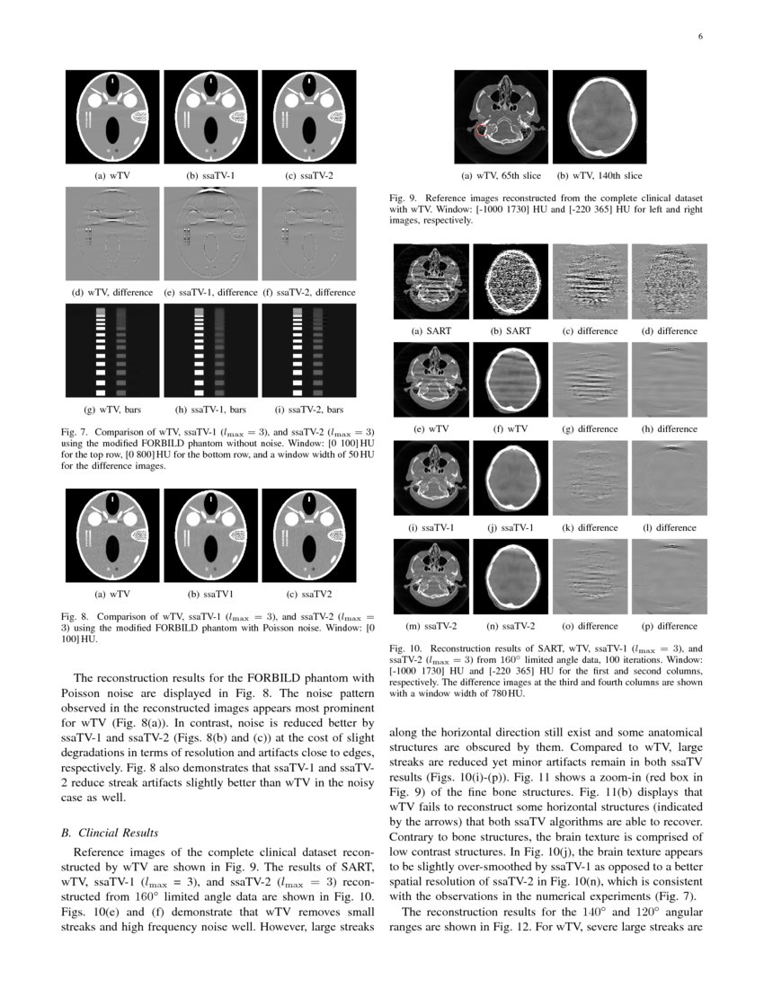 Scale Space Anisotropic Total Variation For Limited Angle Tomography Deepai