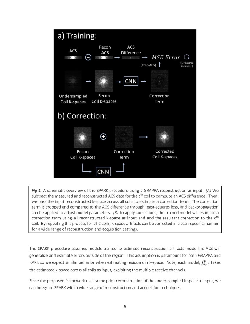 Scan Specific Artifact Reduction in K-space (SPARK) Neural Networks Synergize with Physics-based ...