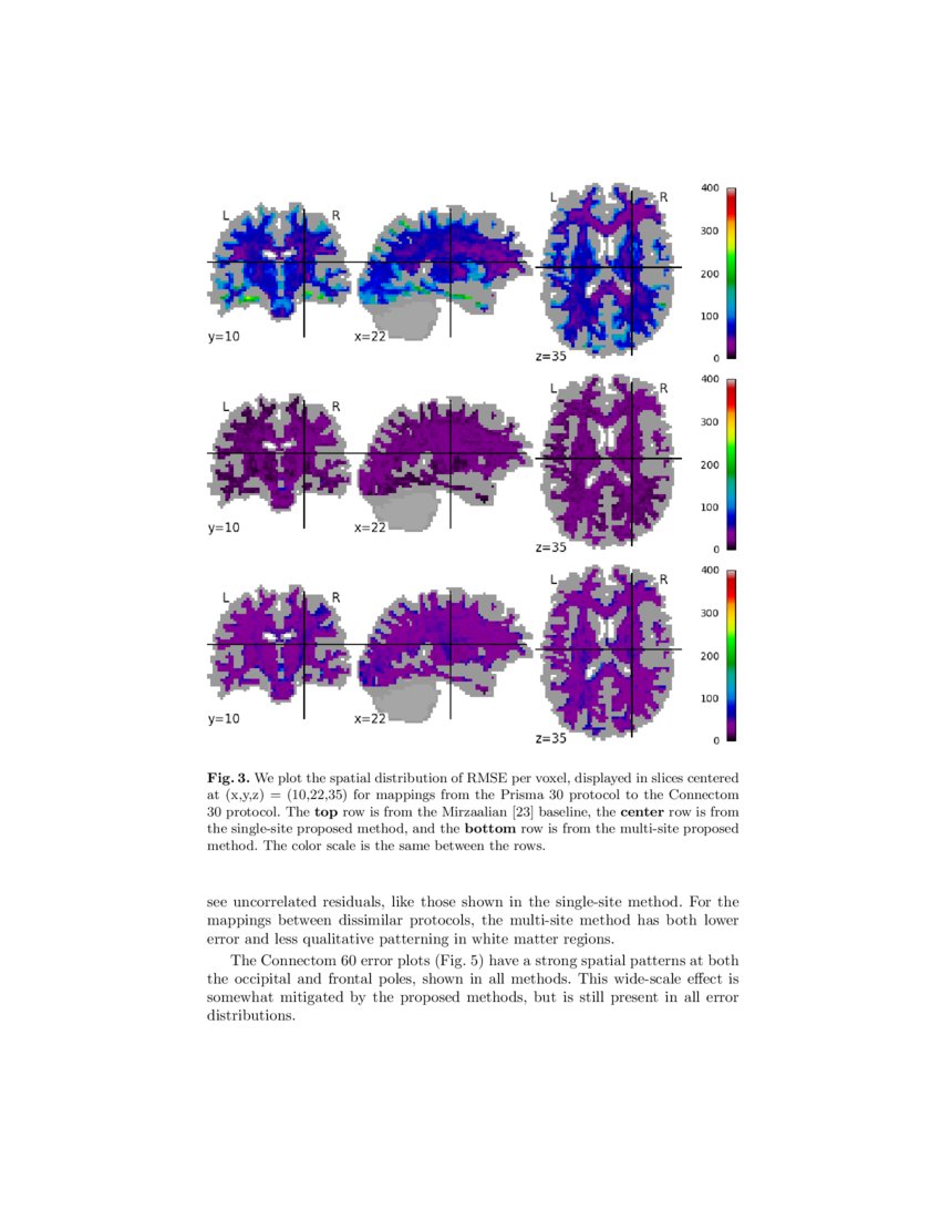 Scanner Invariant Representations for Diffusion MRI Harmonization | DeepAI
