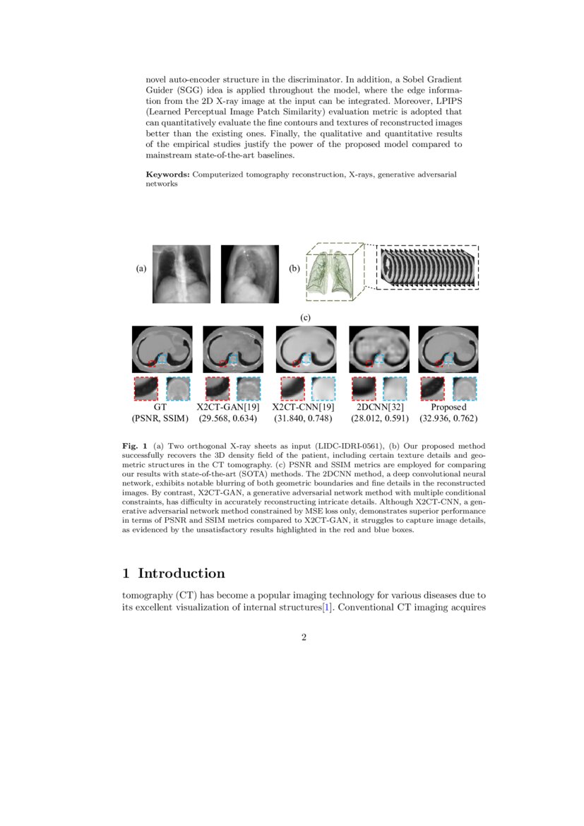 Sdct Gan Reconstructing Ct From Biplanar X Rays With Self Driven
