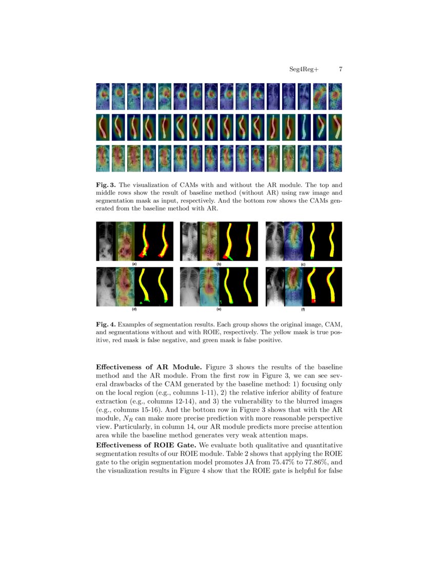 Seg4Reg+: Consistency Learning between Spine Segmentation and Cobb Angle Regression | DeepAI