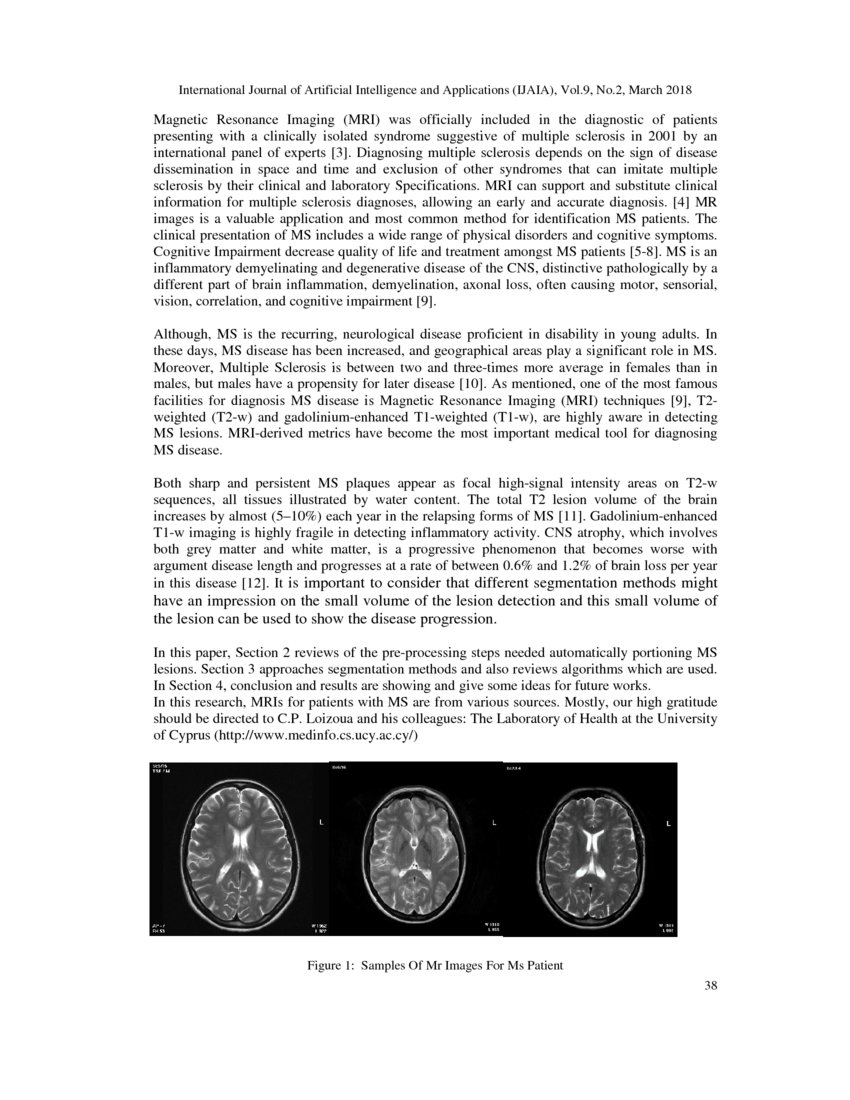 Segmentation of Multiple Sclerosis lesion in brain MR images using Fuzzy C-Means | DeepAI