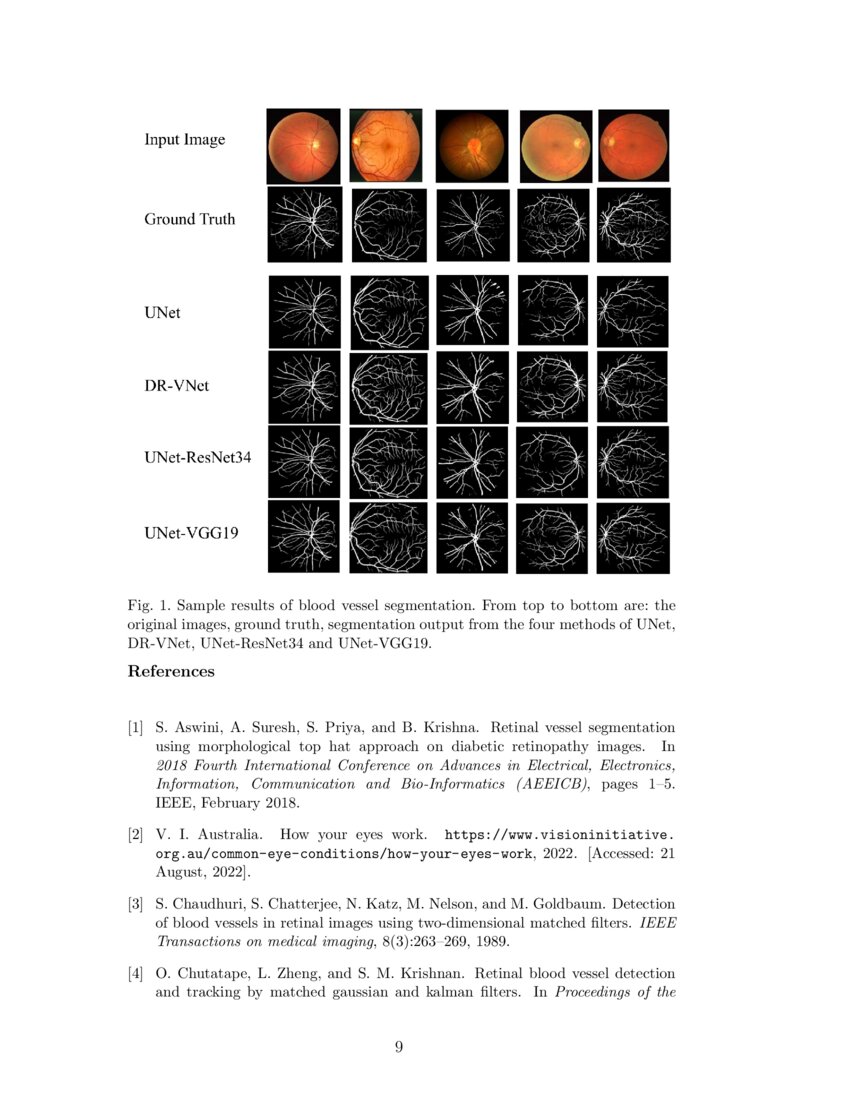 Segmentation of Retinal Blood Vessels Using Deep Learning | DeepAI Segmentation of Retinal Blood Vessels Using Deep Learning | DeepAI