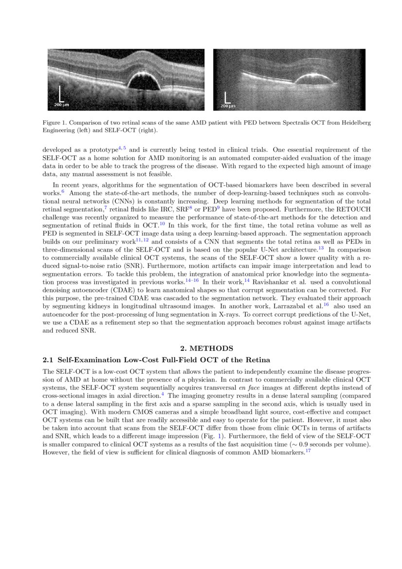 Segmentation of Retinal Low-Cost Optical Coherence Tomography Images ...