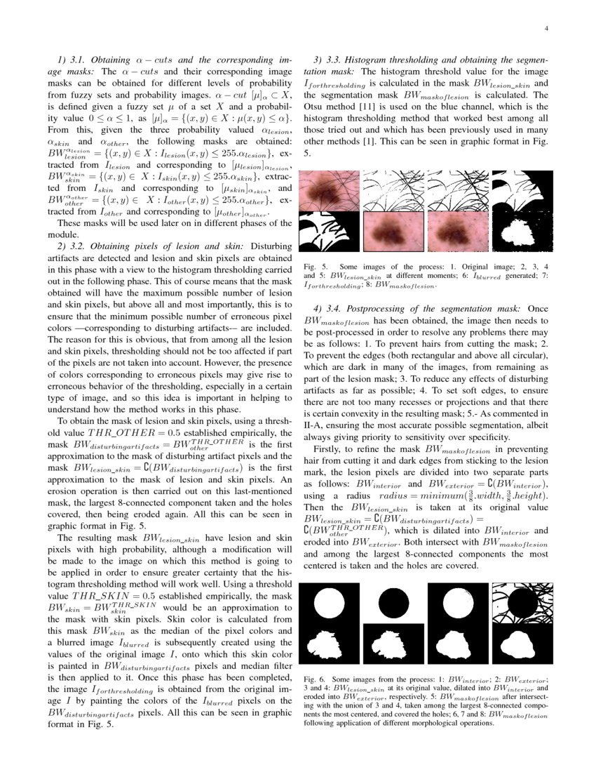 Segmentation Of Skin Lesions Based On Fuzzy Classification Of Pixels And Histogram Thresholding