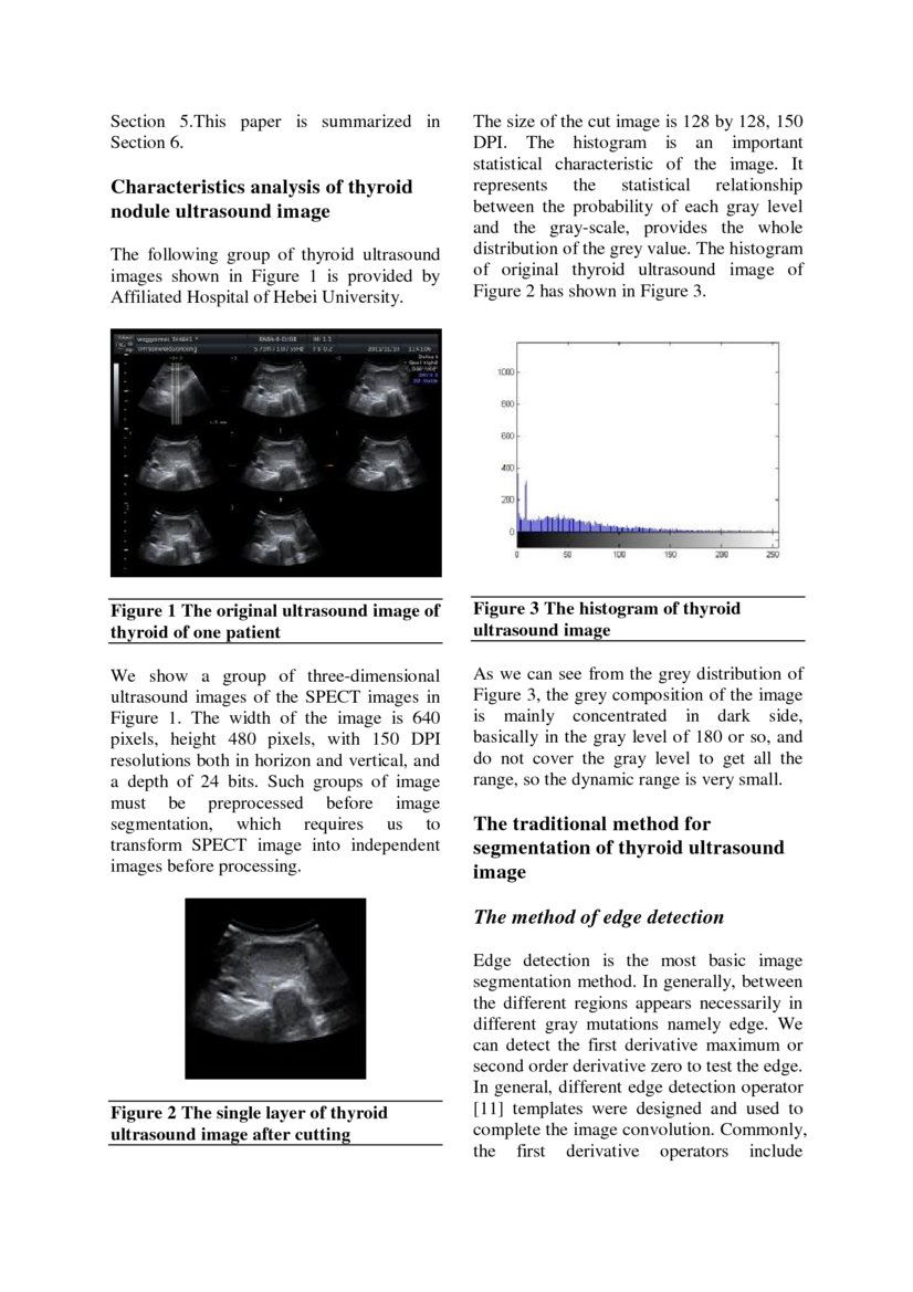 Segmentation of ultrasound images of thyroid nodule for assisting fine needle aspiration ...