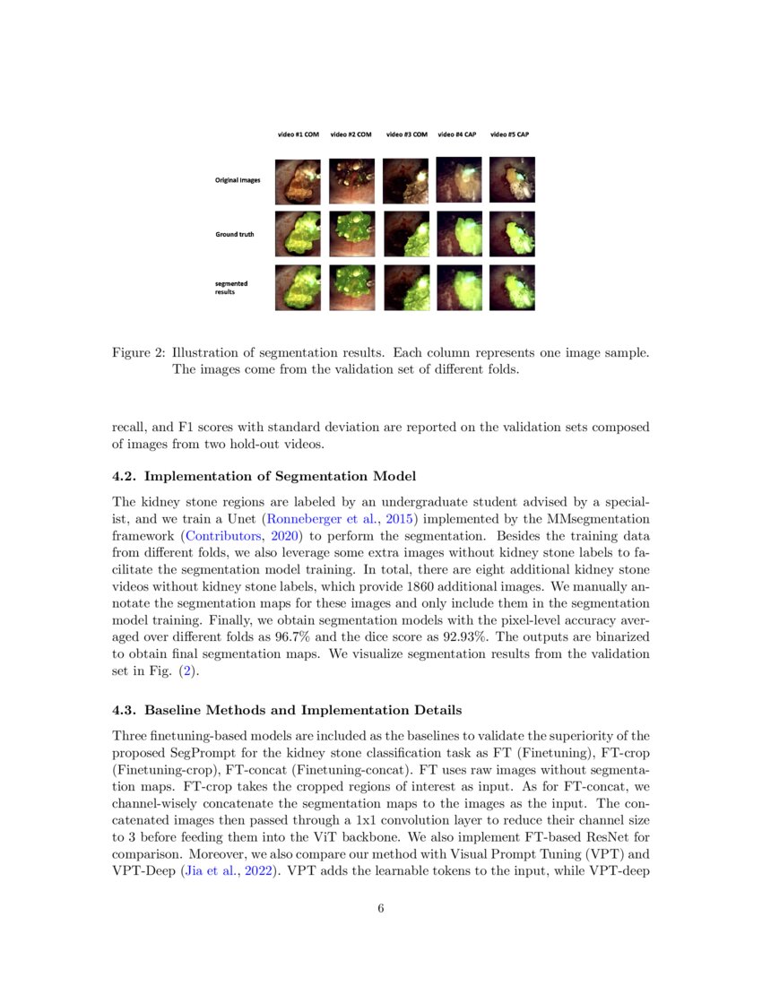 SegPrompt: Using Segmentation Map as a Better Prompt to Finetune Deep Models for Kidney Stone ...