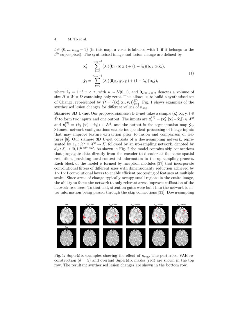 Self-supervised Lesion Change Detection and Localisation in Longitudinal Multiple Sclerosis ...