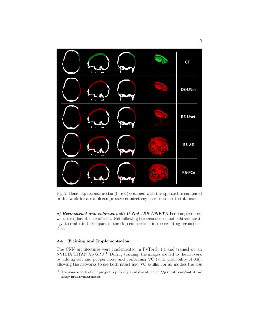 Self-supervised Skull Reconstruction in Brain CT Images with ...