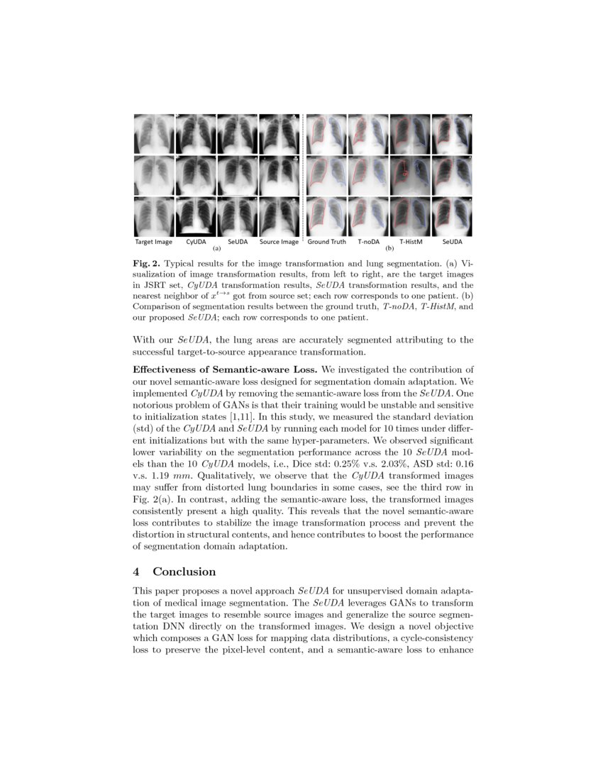 Semantic-Aware Generative Adversarial Nets for Unsupervised Domain Adaptation in Chest X-ray ...