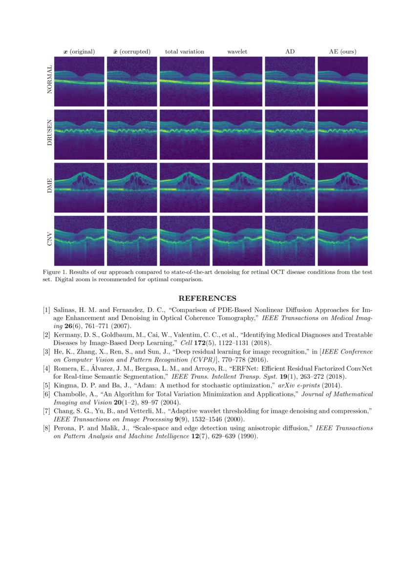 Semantic denoising autoencoders for retinal optical coherence ...