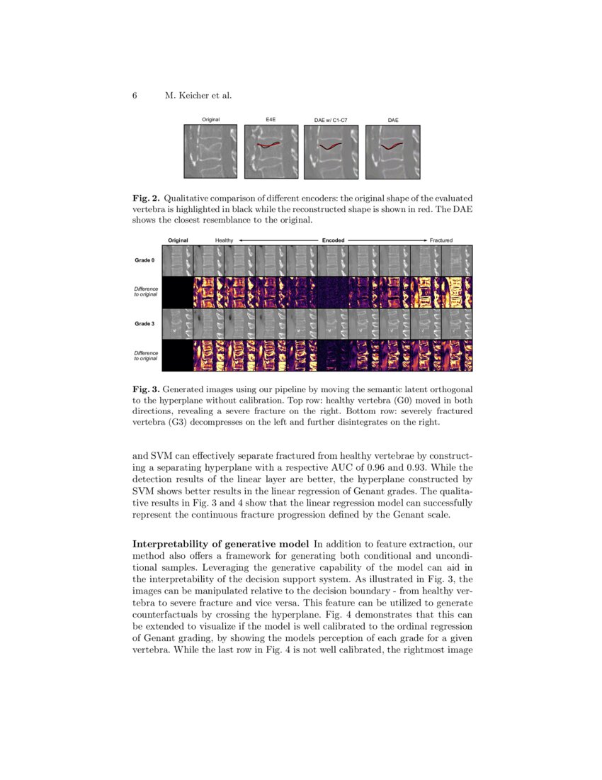 Semantic Latent Space Regression Of Diffusion Autoencoders For Vertebral Fracture Grading Deepai